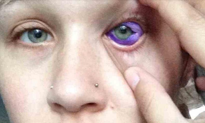 Tatuagem nos olhos: cinco histórias para conhecer antes de fazer isso ...