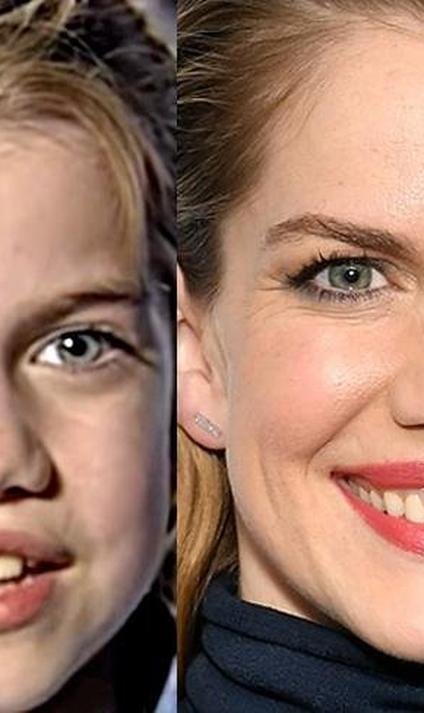 Anna Chlumsky Nose Job