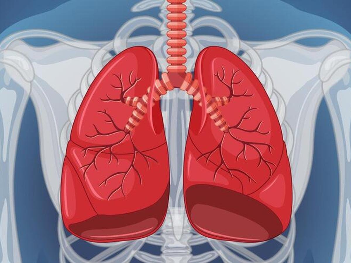 Embolia Pulmonar Grave