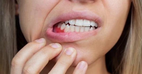 Xerostomia de inverno: quando se preocupar com a boca seca durante ...