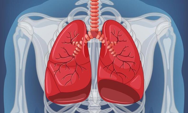 Embolia pulmonar: sintomas leves podem ser confundidos com outras ...