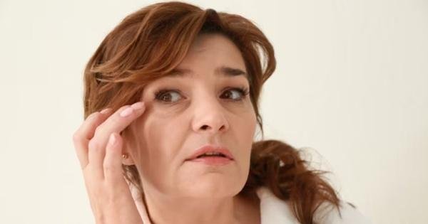 Entenda o que é a síndrome do rosto derretido - Saúde - Estado de Minas