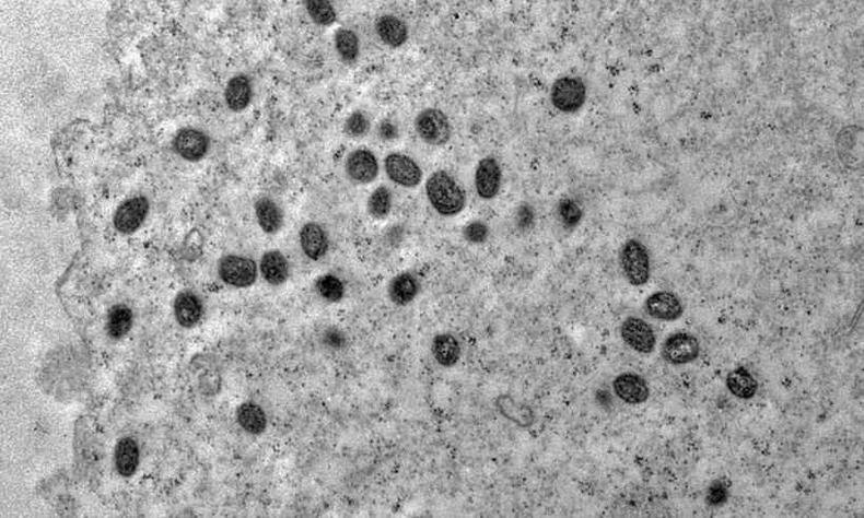 Mpox ainda é problema de saúde pública, dizem especialistas da Fiocruz ...